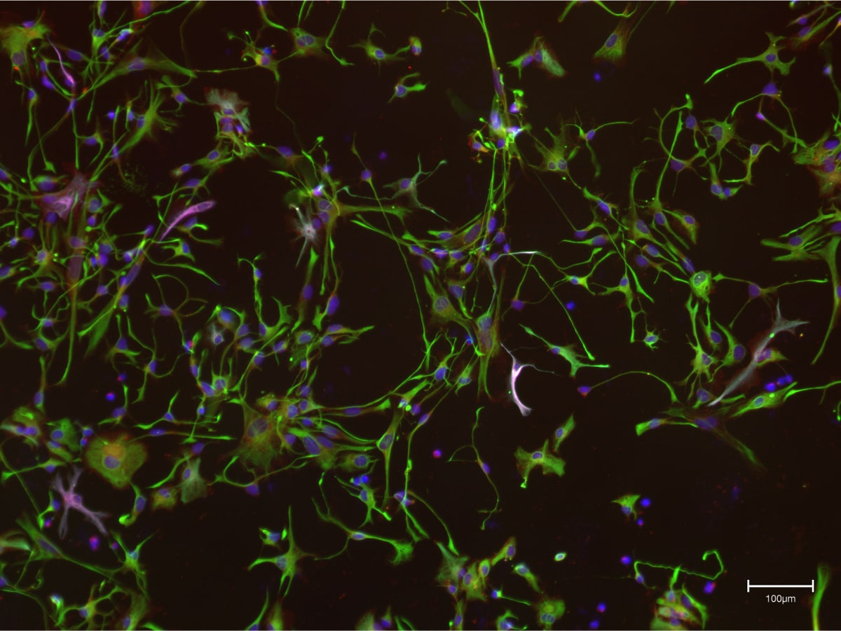 Advancing Modeling for Neurodegeneration in ALS patients | Synapticure